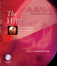 AANA Advanced Arthroscopy: The Hip 1st edition | 9781437709117 ...