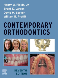 Contemporary Orthodontics 7th edition | 9780323930710, 9780323934534 ...