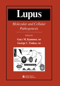 Lupus 1st edition | 9781592597031, 9781592597031 | VitalSource