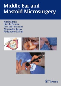 Middle Ear and Mastoid Microsurgery 1st edition | 9783131607317, 9783131607317 | VitalSource